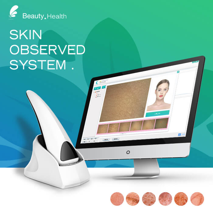 Skin analyzer and skin observed system for beauty salon and distributors