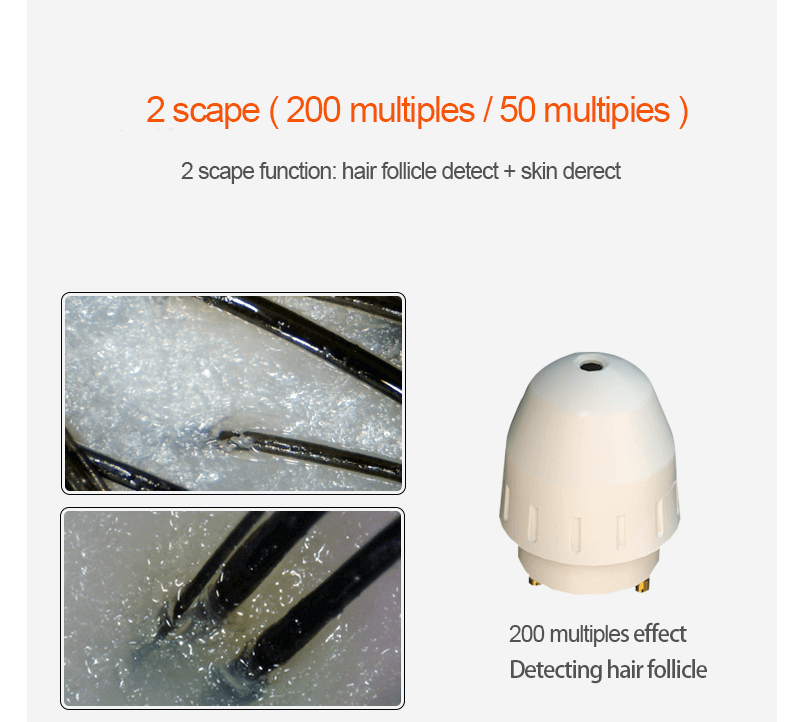 Skin and scalp analyzer different version, with or without report