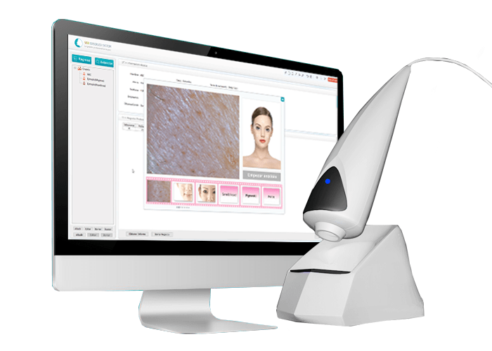 Spanish skin analyser connect with computer use
