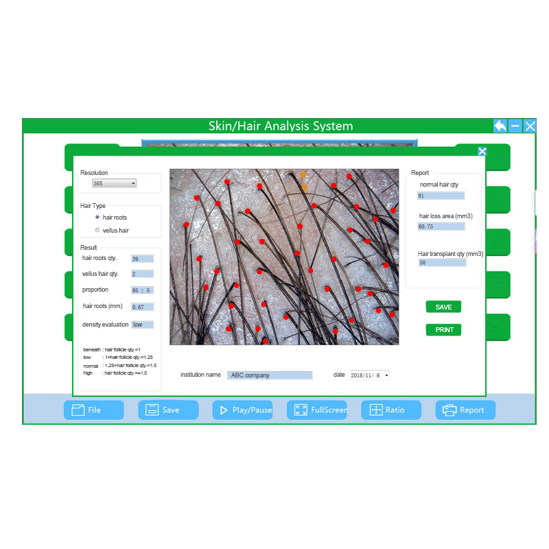 hair scalp analysis machine connect with computer use